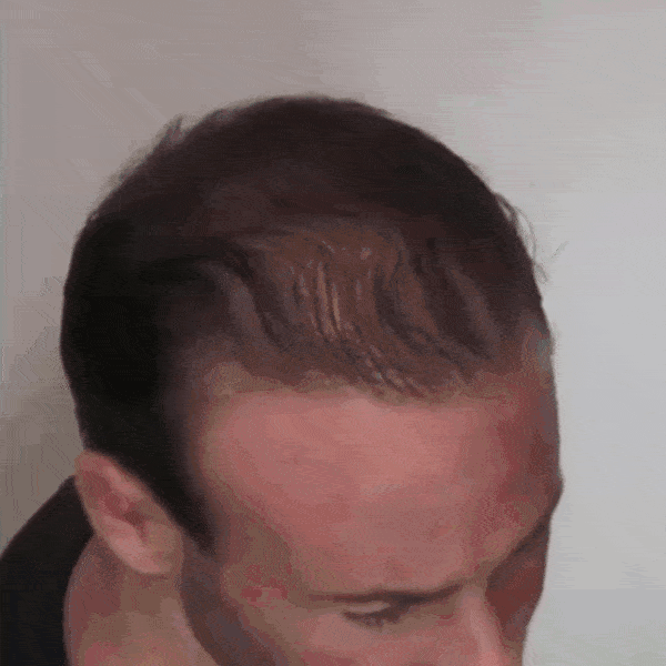 GIF serum – Hanksly.sk